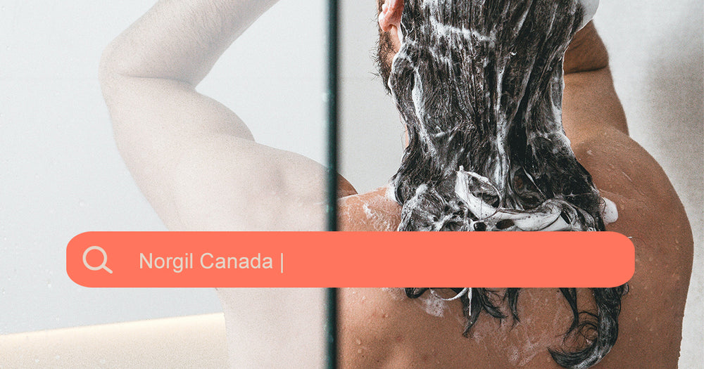 Hair loss – Norgil Canada Santé Capillaire